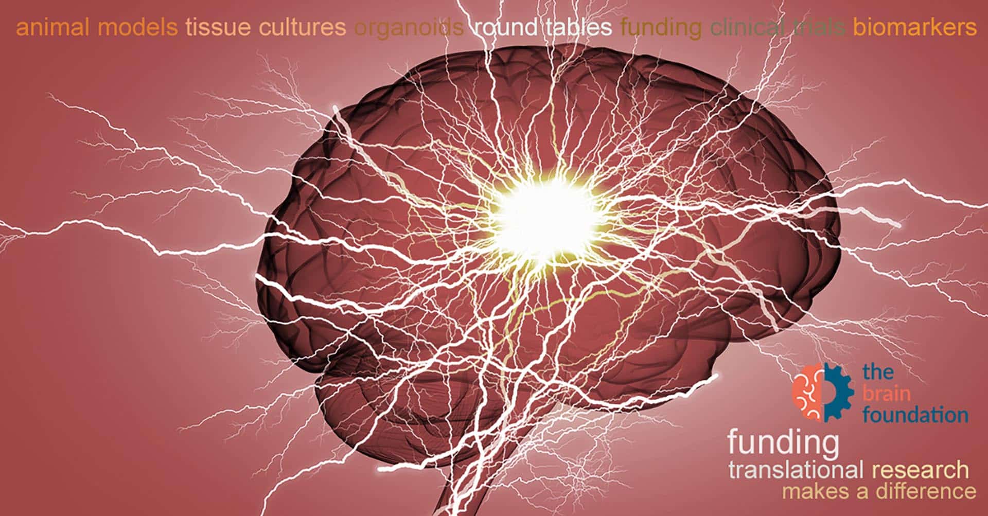 Immunity & inflammation in autism